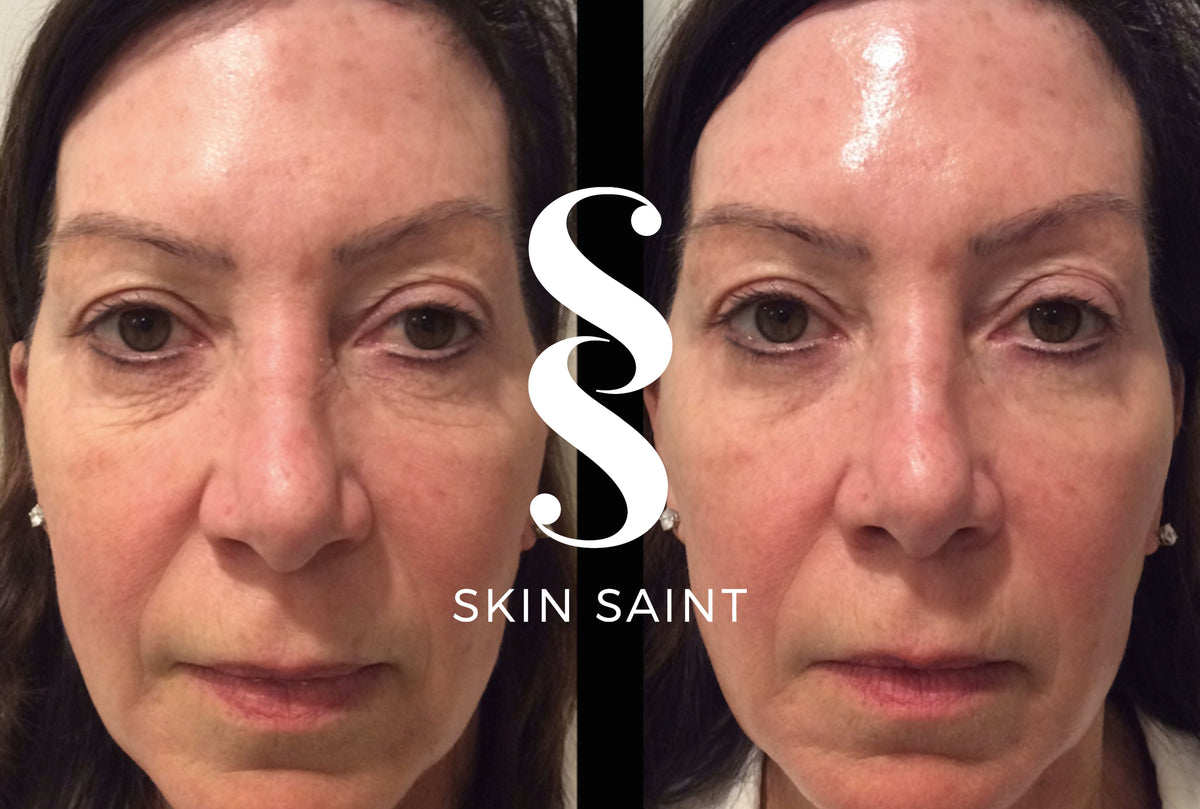 Revive Intro Skin Kit – The Skin Saint